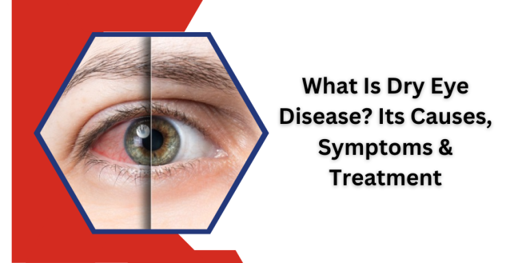 What Is Dry Eye Disease? Its Causes, Symptoms & Treatment